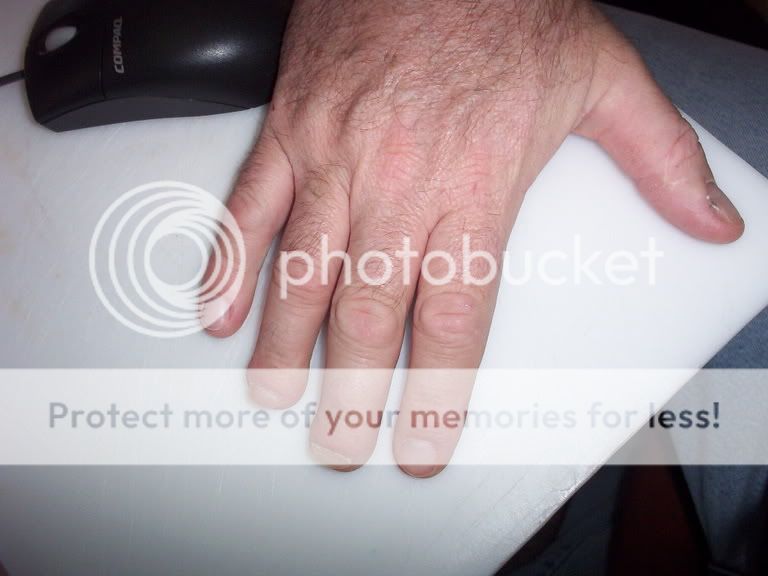 Missing middle finger tip help - Guitar Tricks Forum